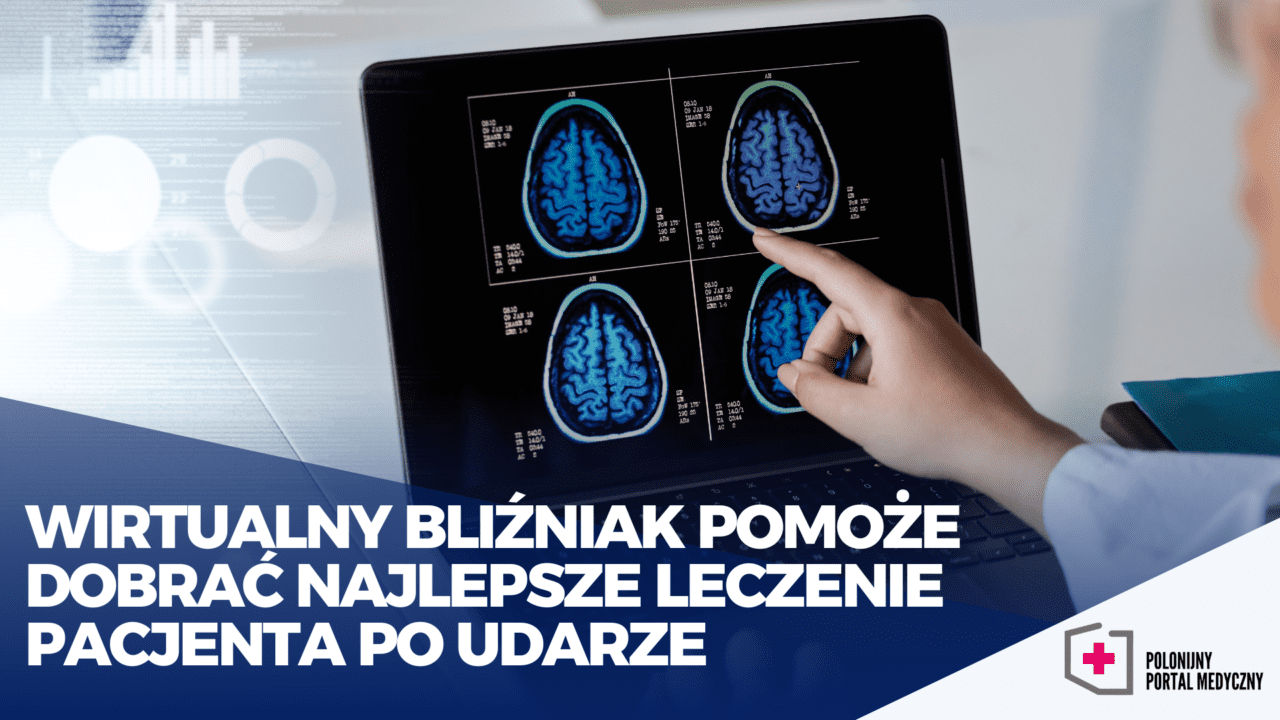Wirtualny bliźniak pomoże dobrać najlepsze leczenie pacjenta po udarze | Polonijny Portal Medyczny